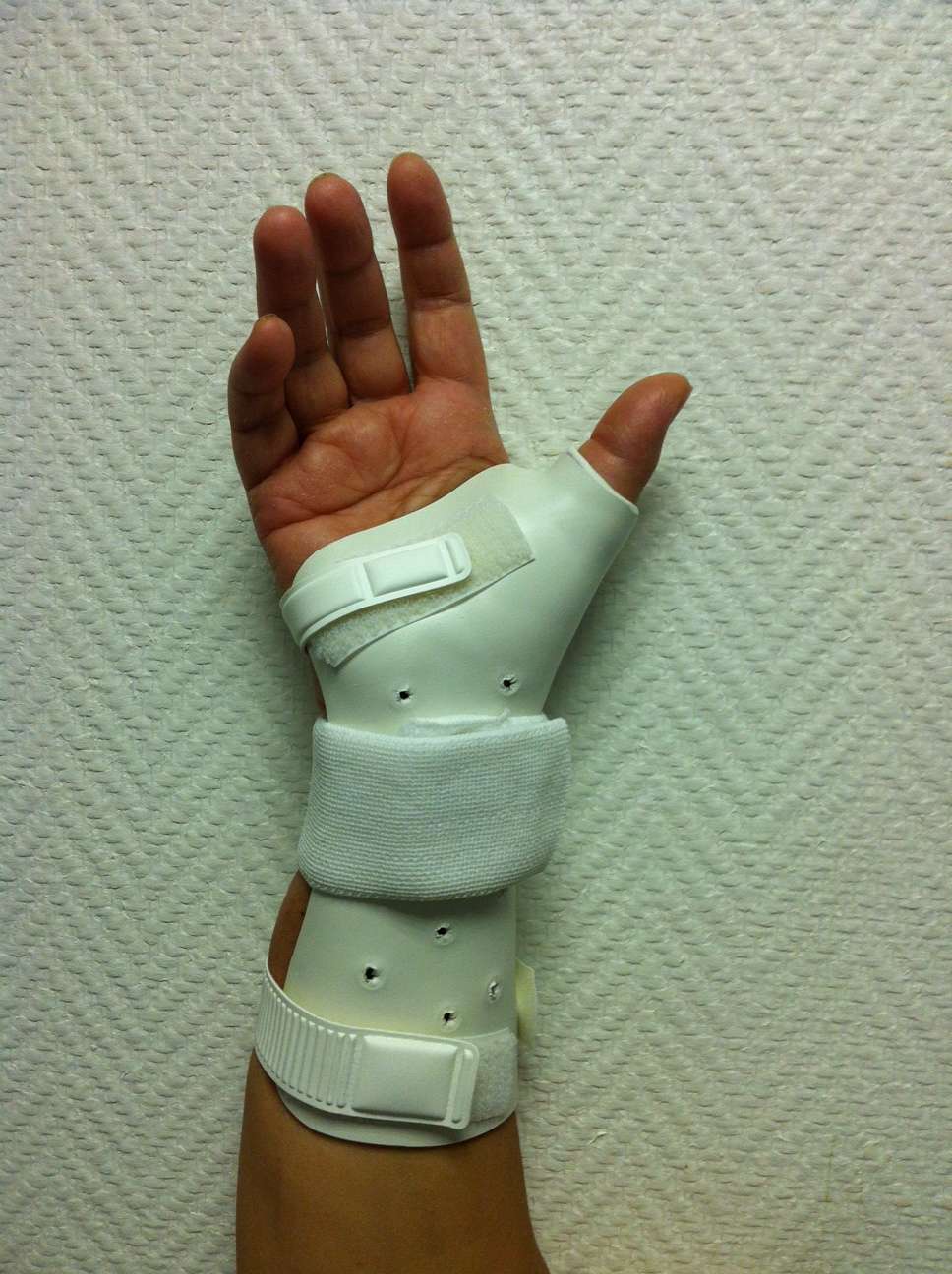 Orthèses thermoformables sur mesure de la main et du membre supérieur ...
