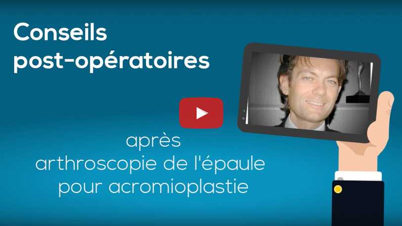Vidéo : Conseils après acromioplastie de l'épaule