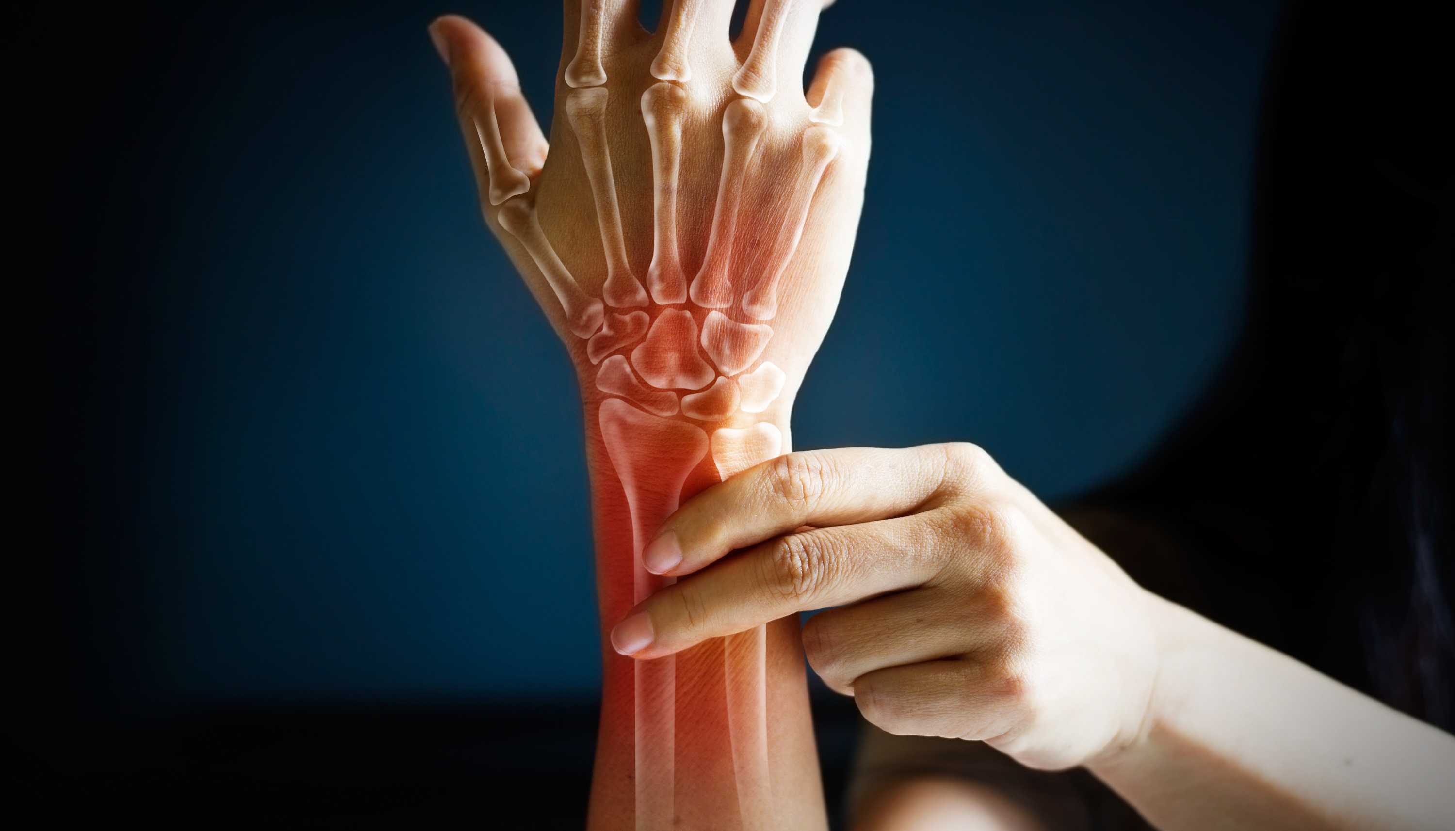 Arthroscopie du poignet : Traitement d'une entorse du poignet