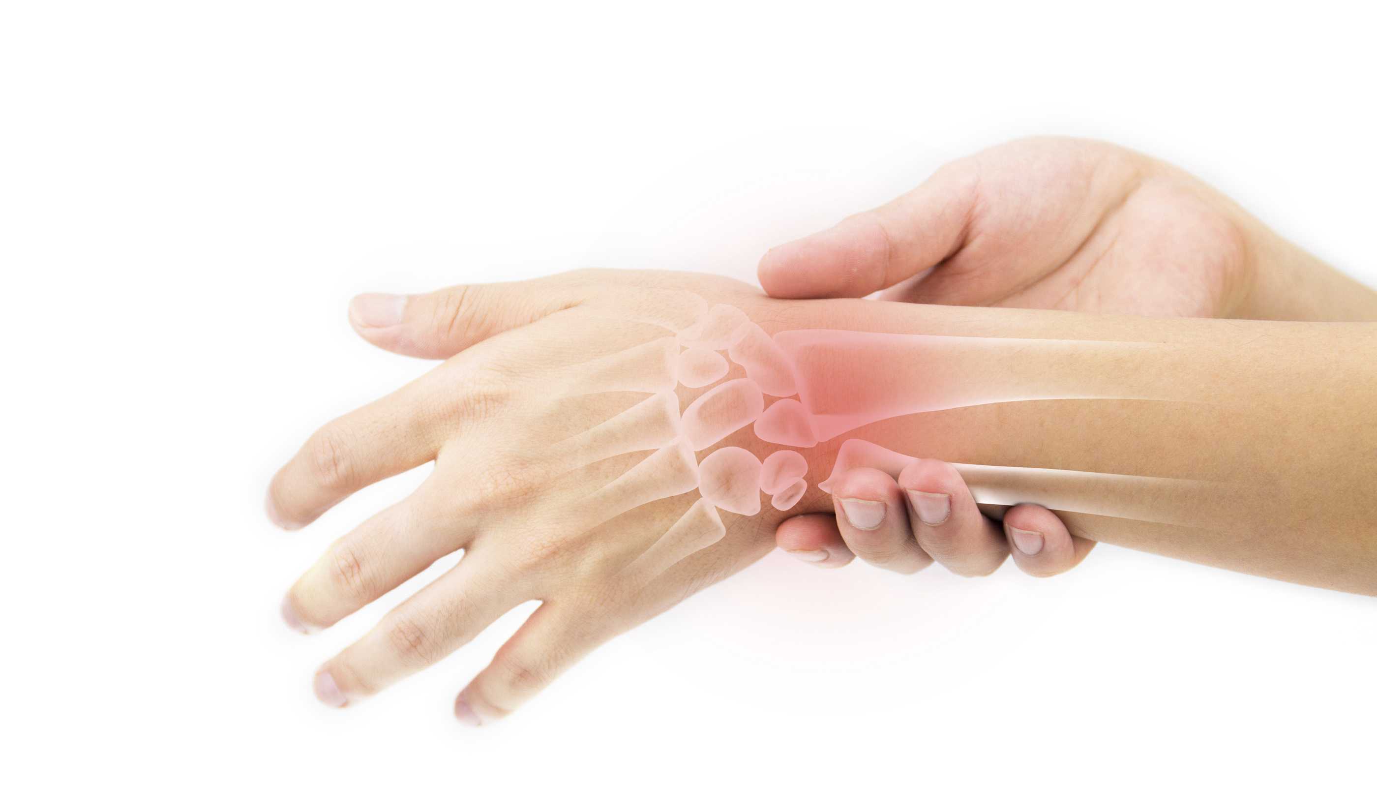 Fracture du scaphoïde : diagnostic et traitements - Dr Roure